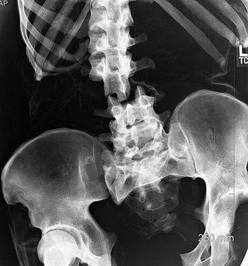 Inconvenients :: Avantatges de fer esport.